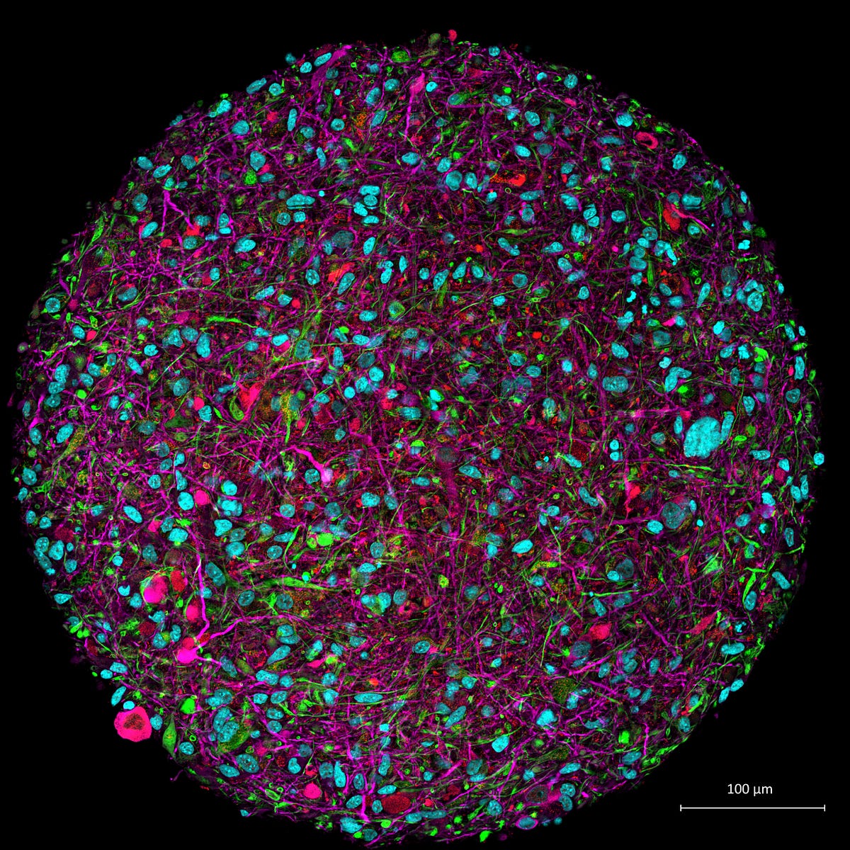 Could brain cells in a dish help computers solve complex problems? | by ...