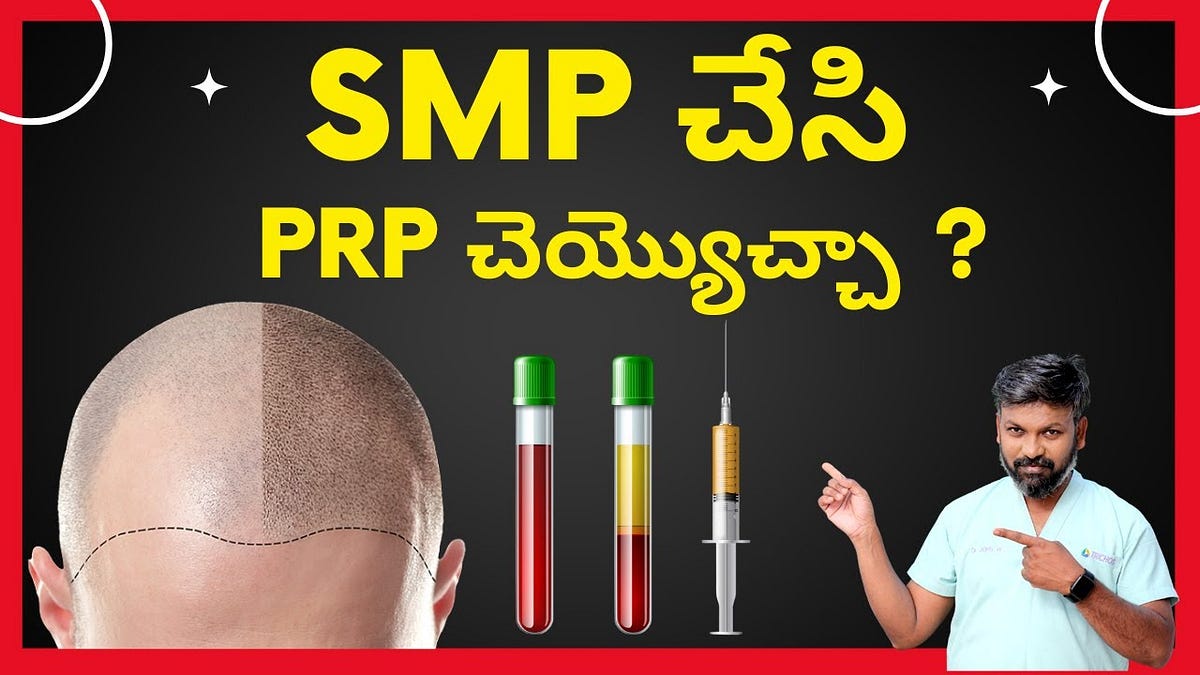 If after undergoing Scalp Micropigmentation (SMP), can undertake ...