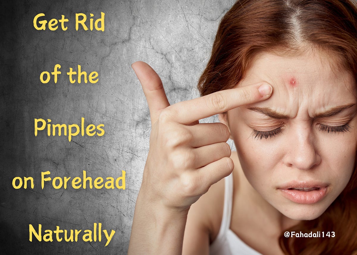 How to Get Rid of the Pimples on Forehead Naturally | by Fahad ali | Oct, 2024 | Medium
