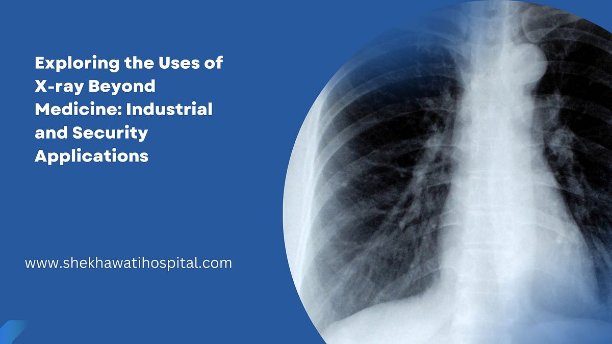 Exploring the Uses of X-ray Beyond Medicine: Industrial and Security ...