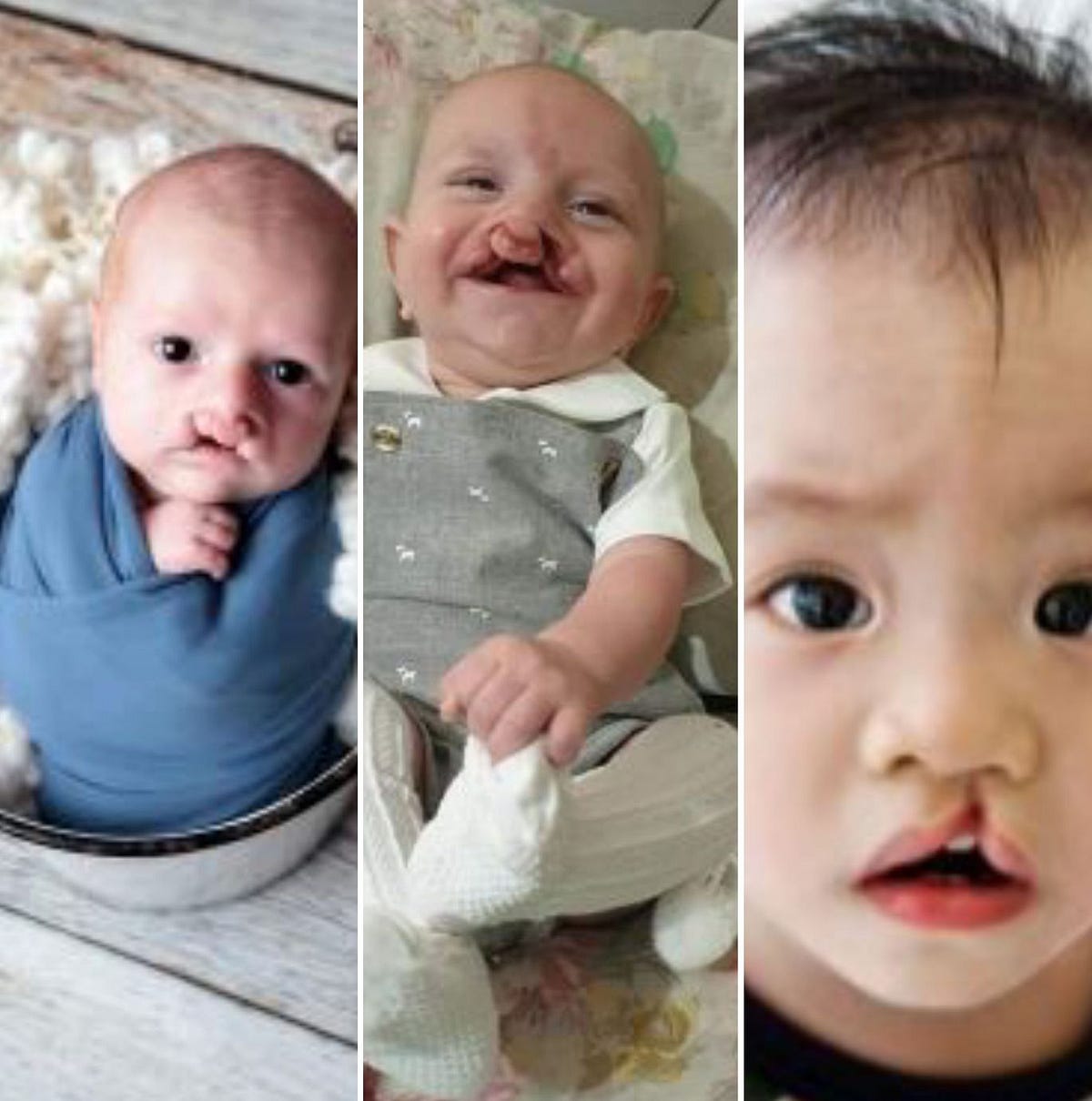 “A Holistic View of 3MC Syndrome” | by Arsh | Feb, 2024 | Medium