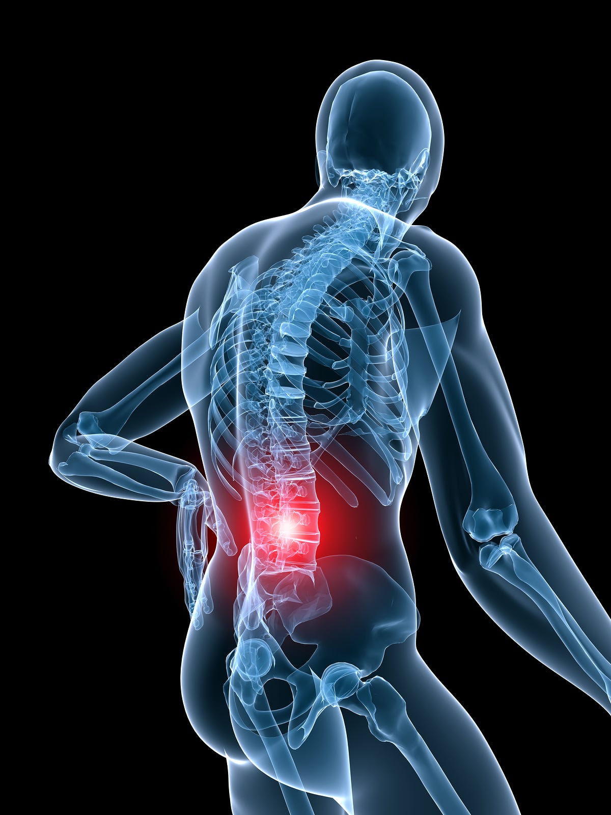 Physiotherapy for low back disorder | by Wohl Physio | Medium