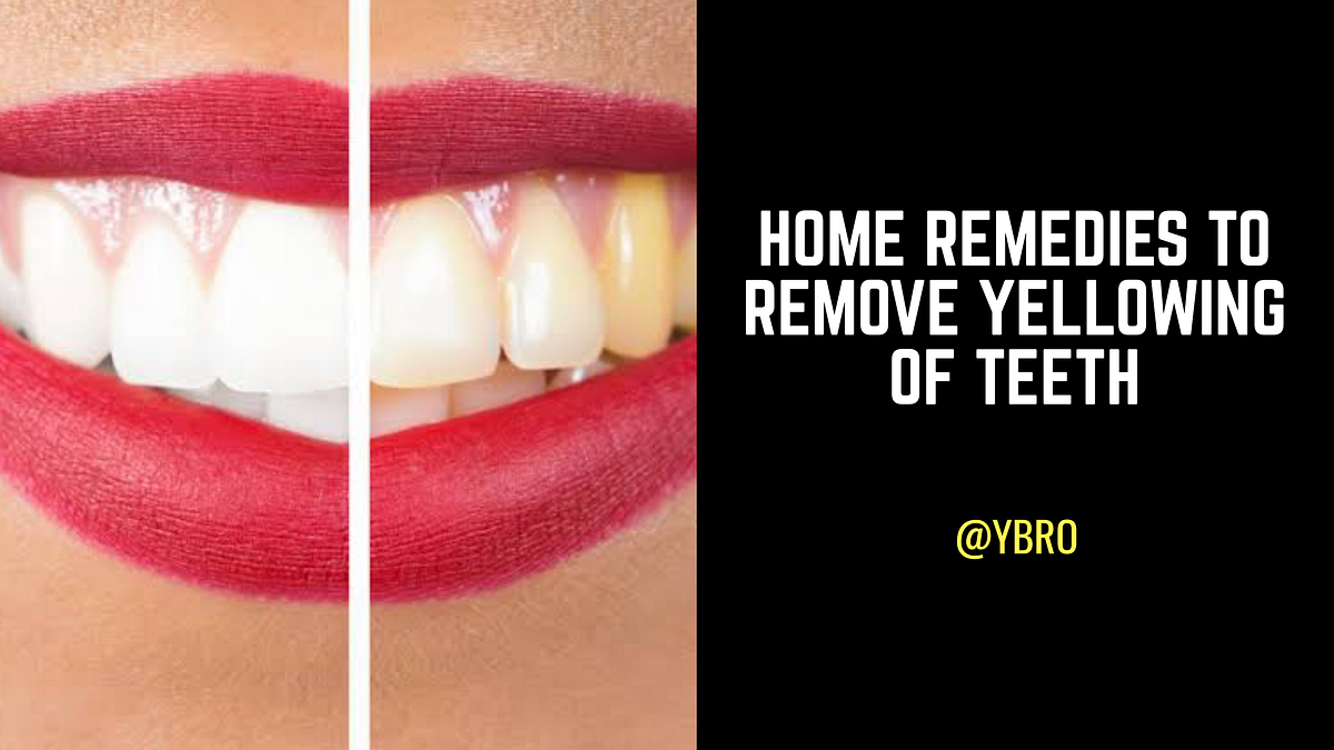 Home remedies to remove yellowing of teeth | by Kpmahesh | Medium