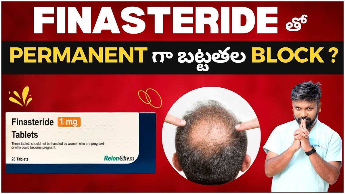 If one stops using Finasteride, does androgenetic alopecia come back ...