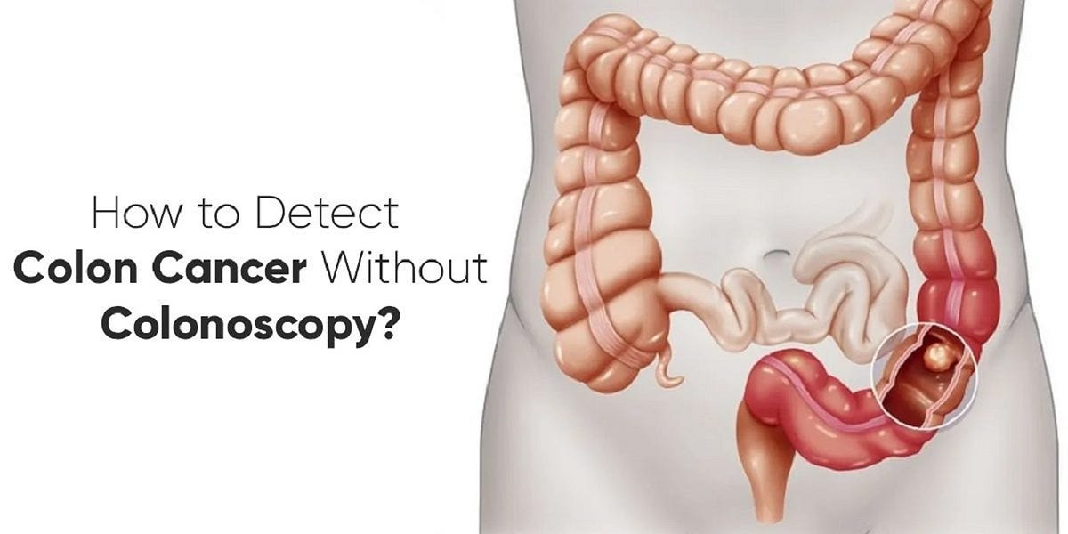 HOW TO DETECT COLON CANCER WITHOUT COLONOSCOPY? - Dr. Mark D'Andrea ...