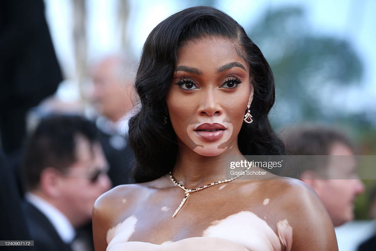 10 Rarest Black People Who are 1 in a Million - donald110683 - Medium