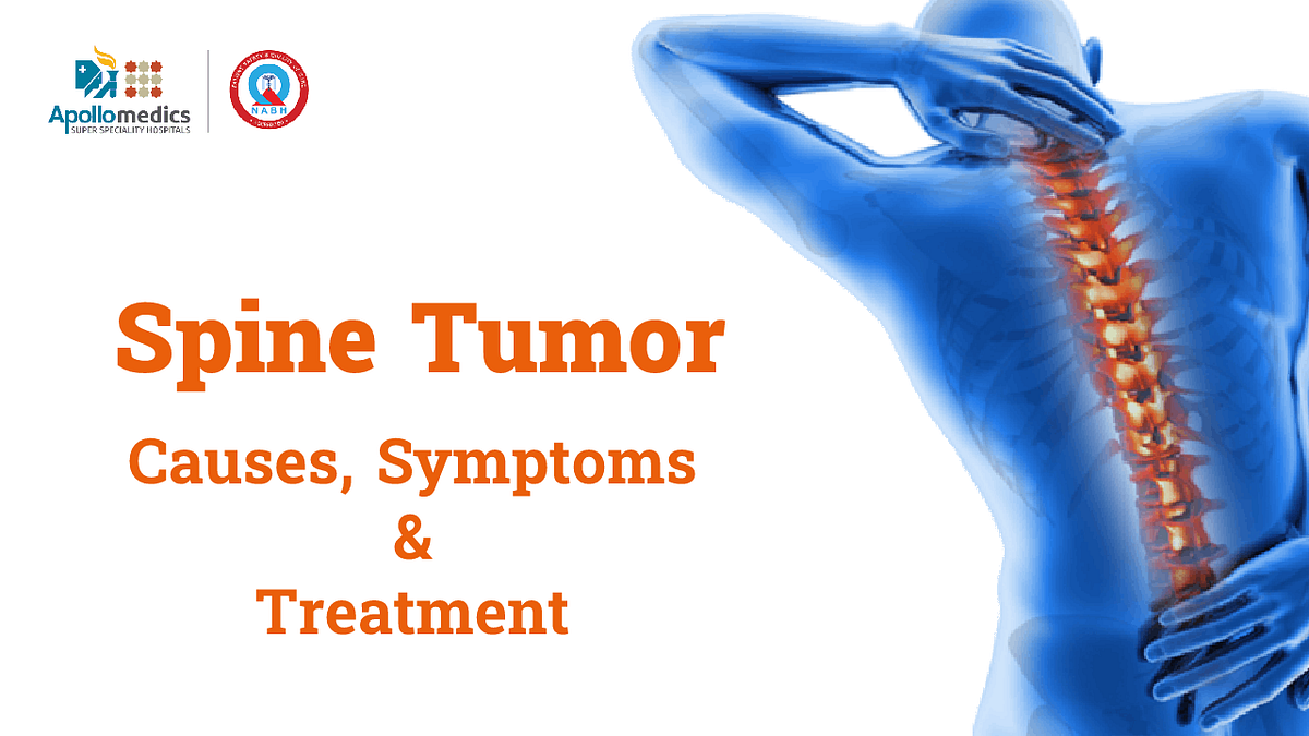 Best Spine Surgeon in Lucknow: Apollomedics | by best hospitals in ...