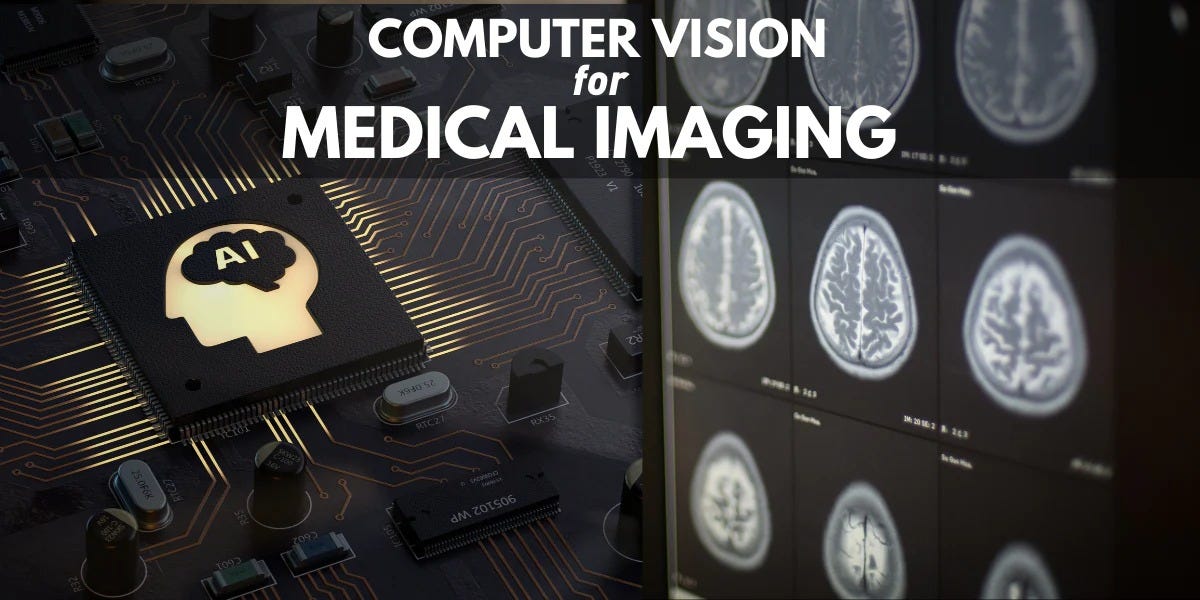 Enhancing Medical Imaging with Computer Vision: An In-Depth Analysis ...