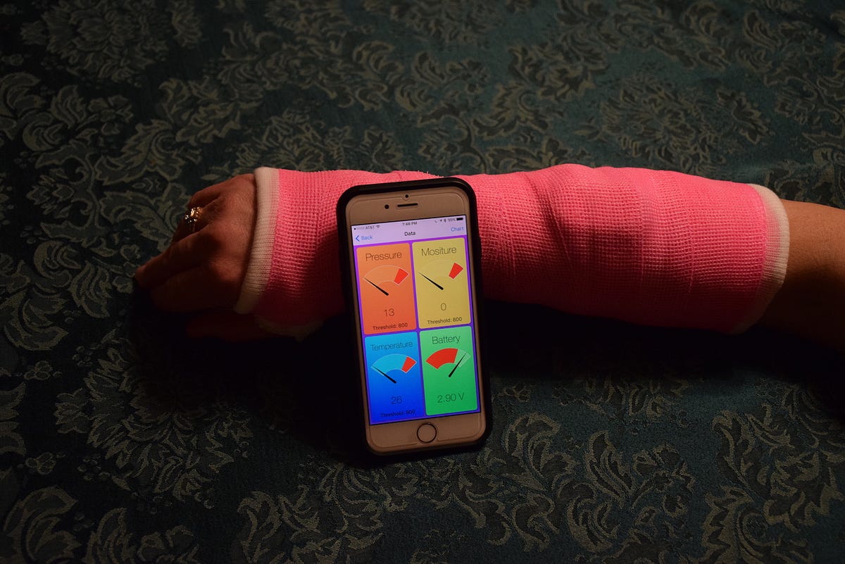 CastMinder — A Smart Cast Monitoring System made by a 16-year-old | by ...