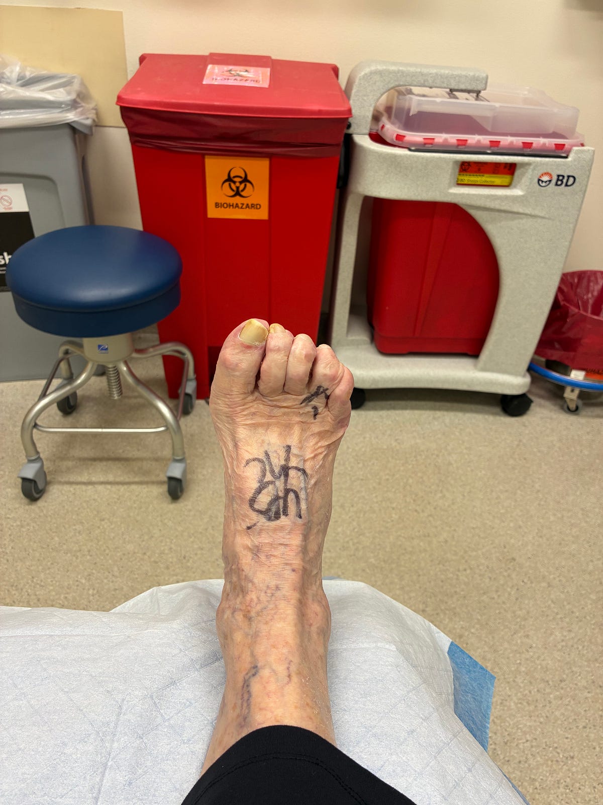 How to Get a New Toe in 20 Minutes | by FranMorelandJohns | The Haven ...
