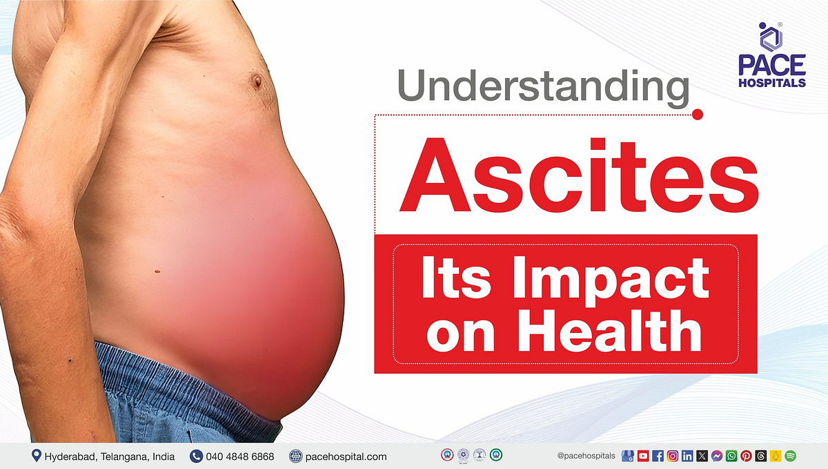Liver Ascites Symptoms: Ascites Symptoms And Treatment – OHZC