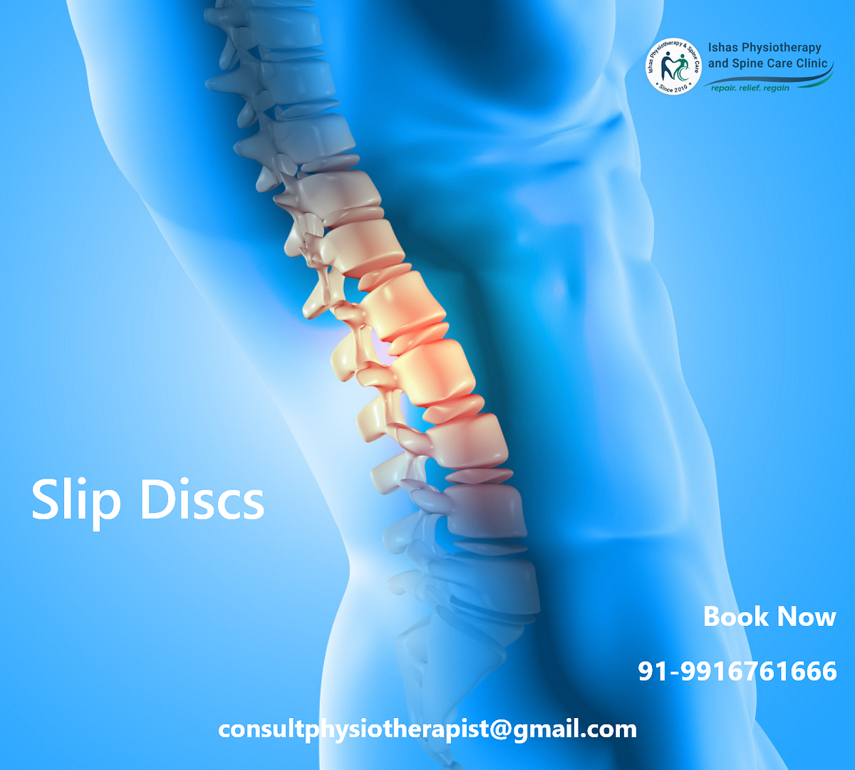 Don’t Ignore These 5 Warning Signs of a Slip Disc | by ...