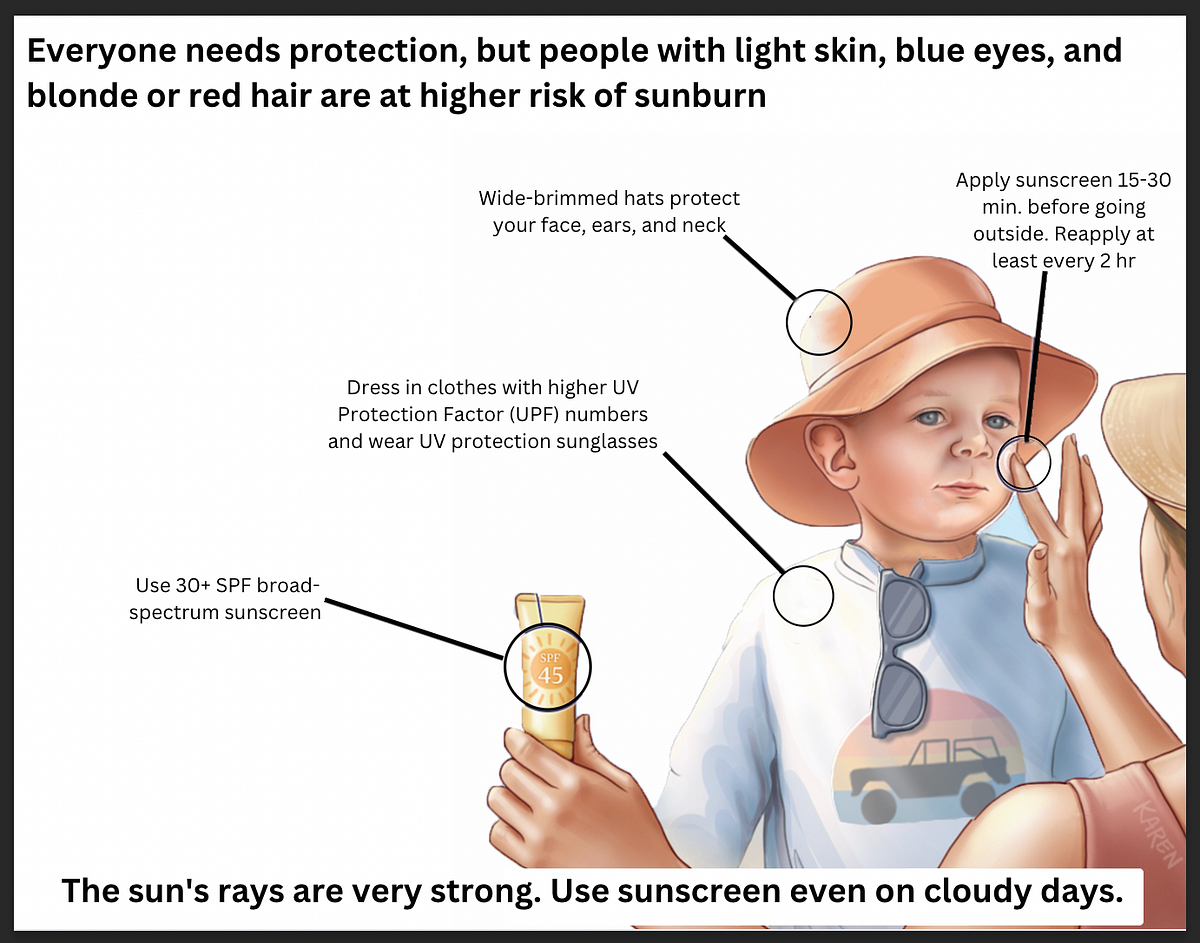 What Parents Should Know About Sun and Sunburns in Children | by Faith ...
