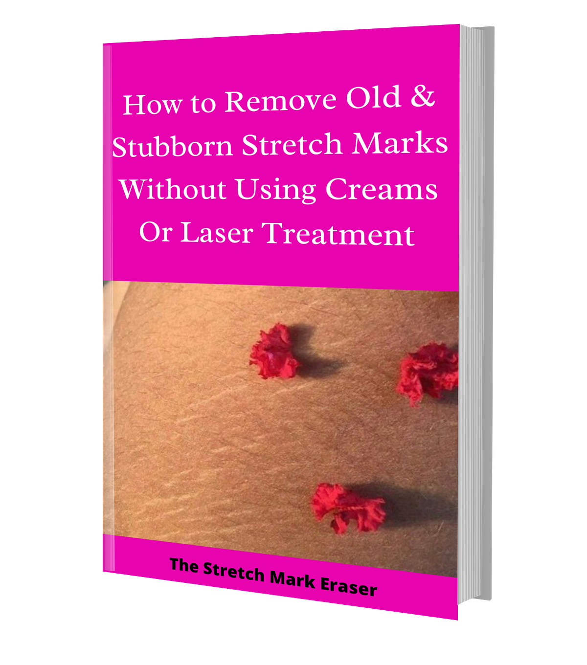 Solution To Stretch Marks. Hi, | by Adetoye Ayomikun | Medium
