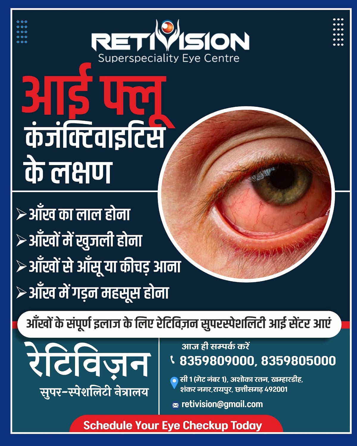 Symptoms of Eye Flu Conjunctivitis — Retivision Superspeciality Eye ...