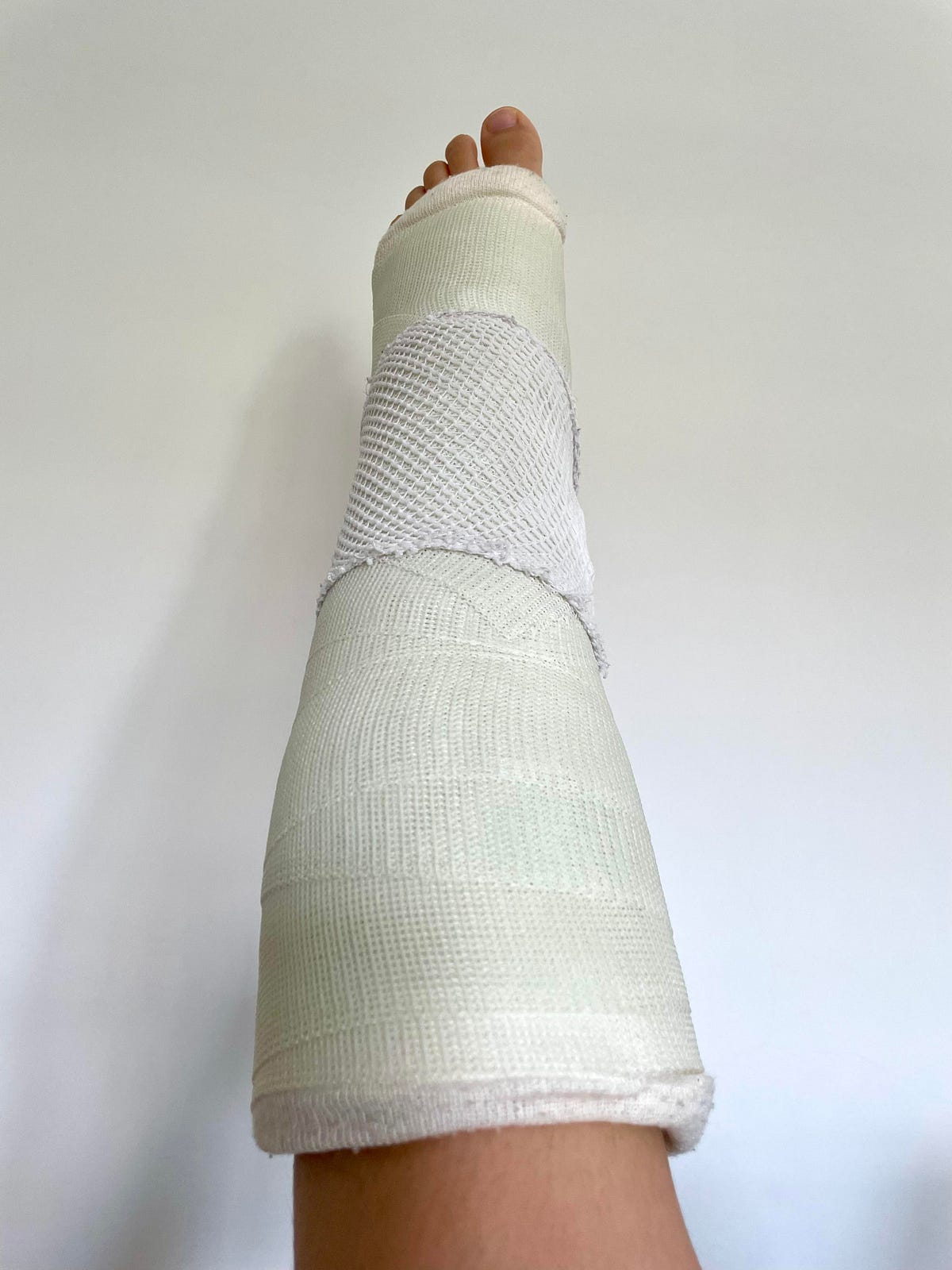 Ruptured Achilles Tendon — Journey to Recovery | by Jolynn Lim | Medium