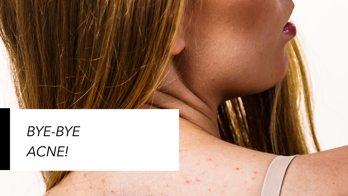 Struggling with back acne? The most effective skincare for acne-free ...