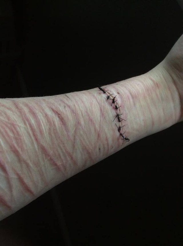 Cutting Arms Scars