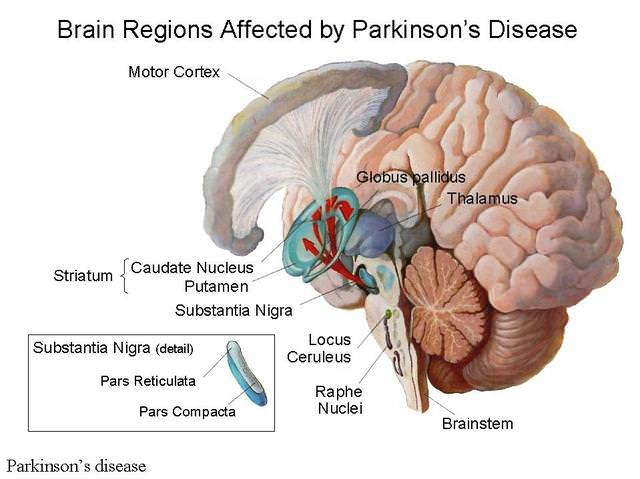 Parkinsons Disease Brain Anatomy 8022