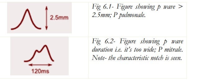 P Mitral Left: The Anatomical Reciprocal Position Of The Aortic,