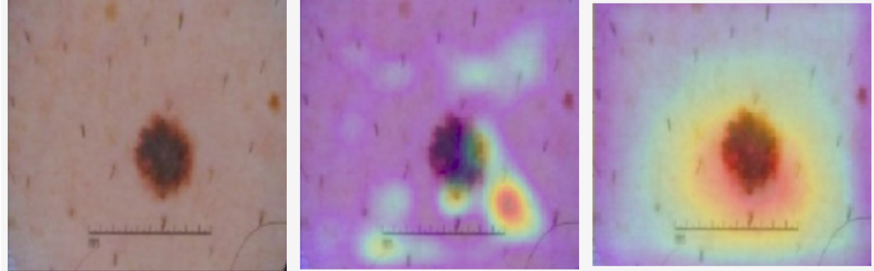 Class Activation maps. This work is a part of the AI Without… | by ...