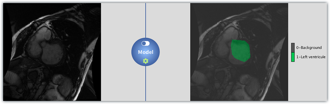 Building Your Own Object Detector Model Using FasterRCNN In DLP | by ai-dlp | Medium