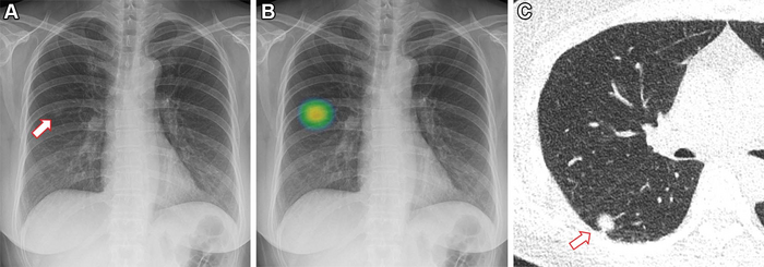 Pac Radiology System: Revolutionizing Medical Imaging Efficiency | by ...