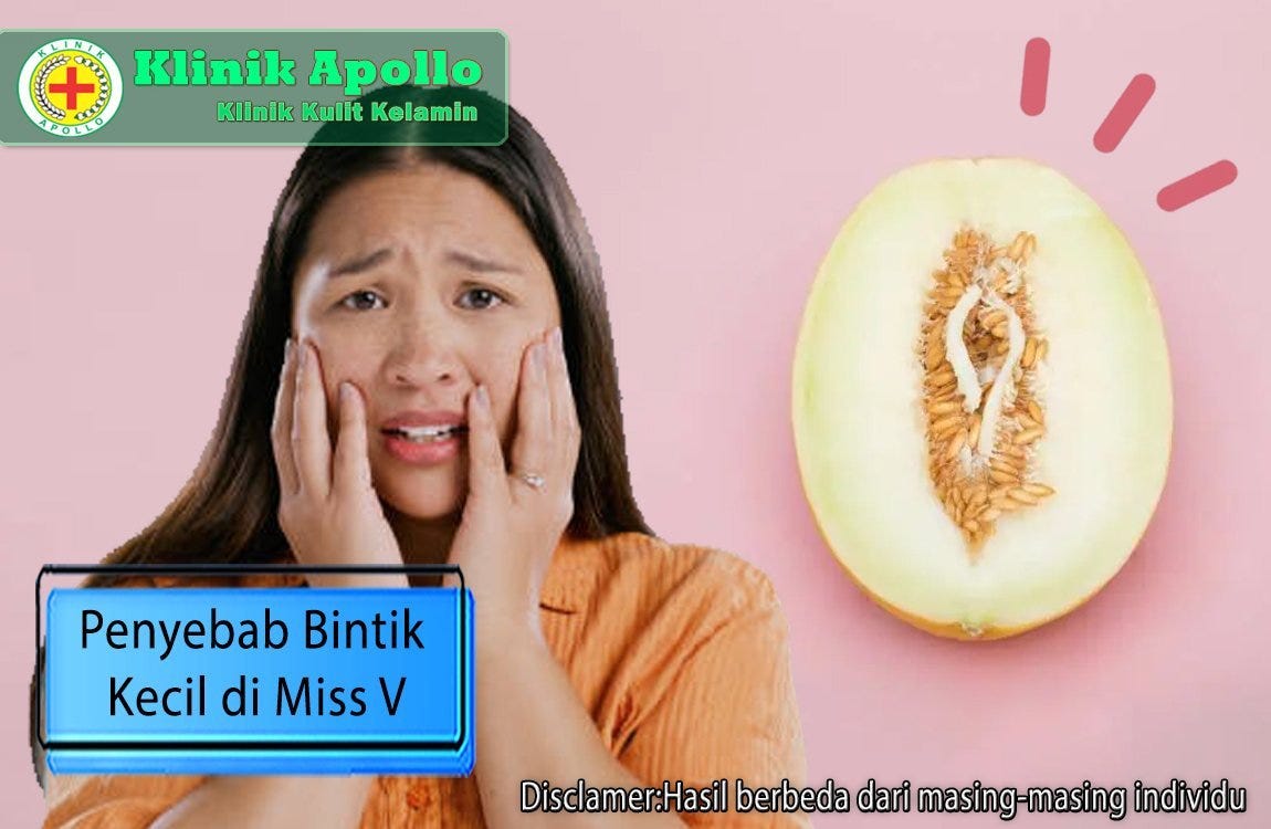 Wanita Harus Tahu! Waspadai 3 Penyebab Miss V Berbau Busuk | by Luciana Septha | Apr, 2024 | Medium