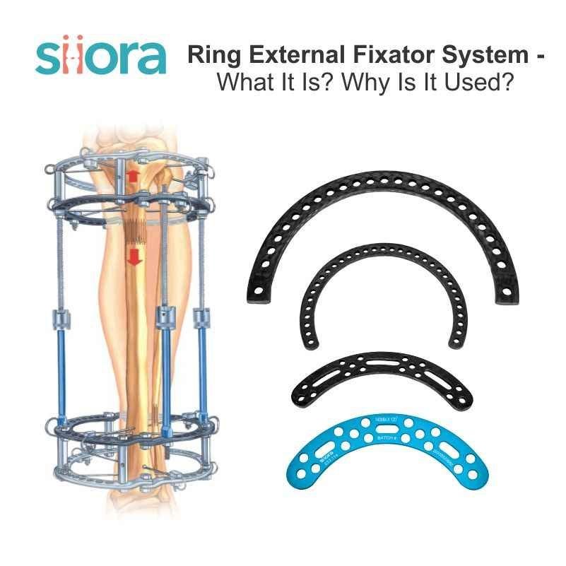 Unraveling the Link Between Obesity and Orthopedic Health - Siora ...