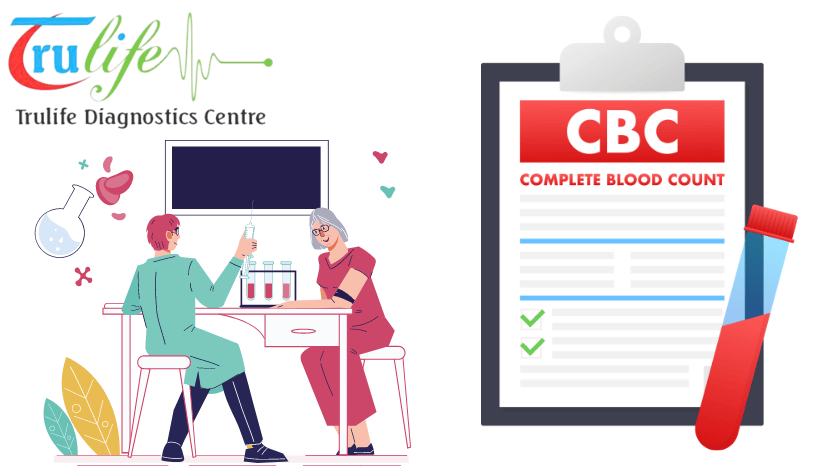 Healthcare at Your Convenience: Home Blood Tests in Suncity Hyderabad ...