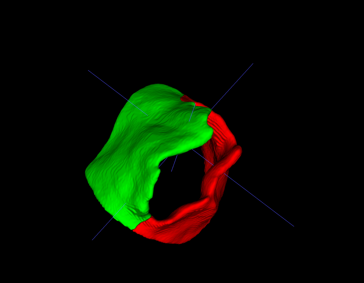 Unlocking the Power of 3D Visualization in Medical Imaging with Python and Vedo | by Mohammed El ...
