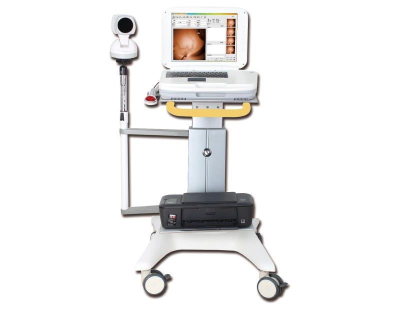 Principle of HD Digital Electronic Colposcope | by YKD-2002 Medical ...