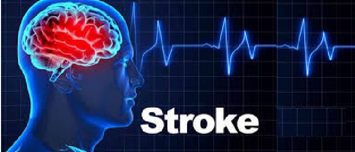 Mobility after stroke Series 1 Episode 4 | by Bobbi's Blog | Feb, 2025 | Medium