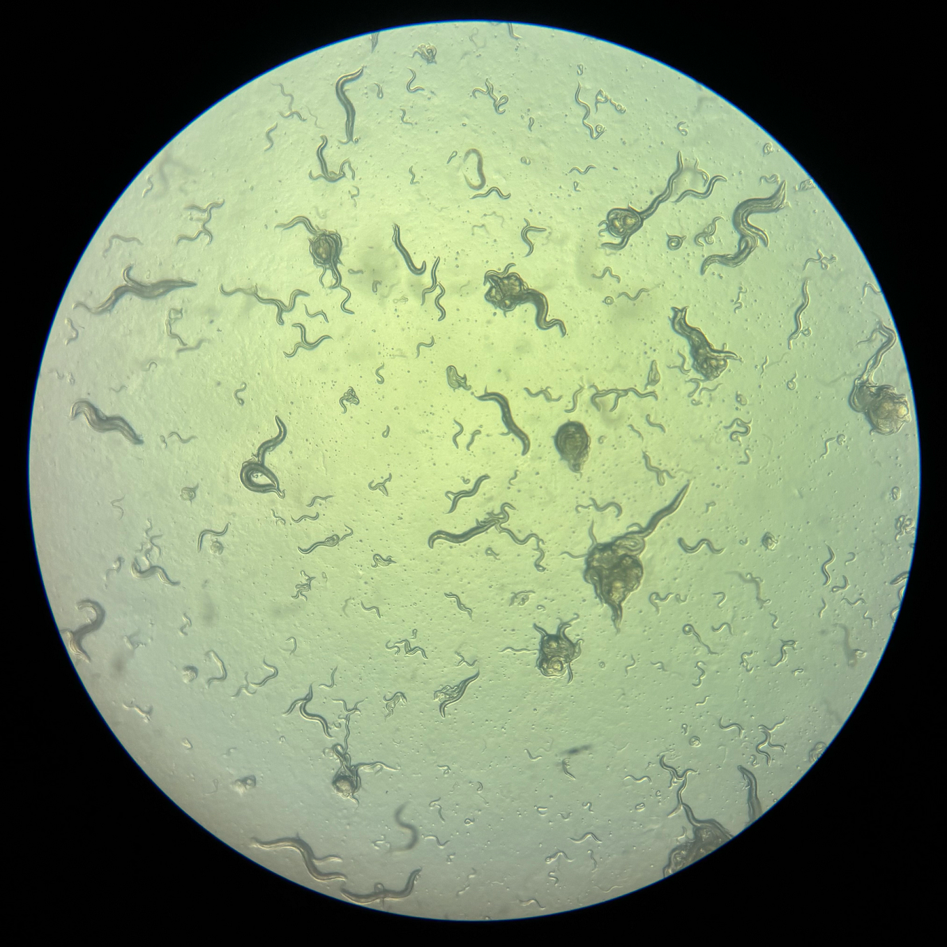 What is Fermentation?. When people are asked the classic… | by Harvard Undergraduate ...