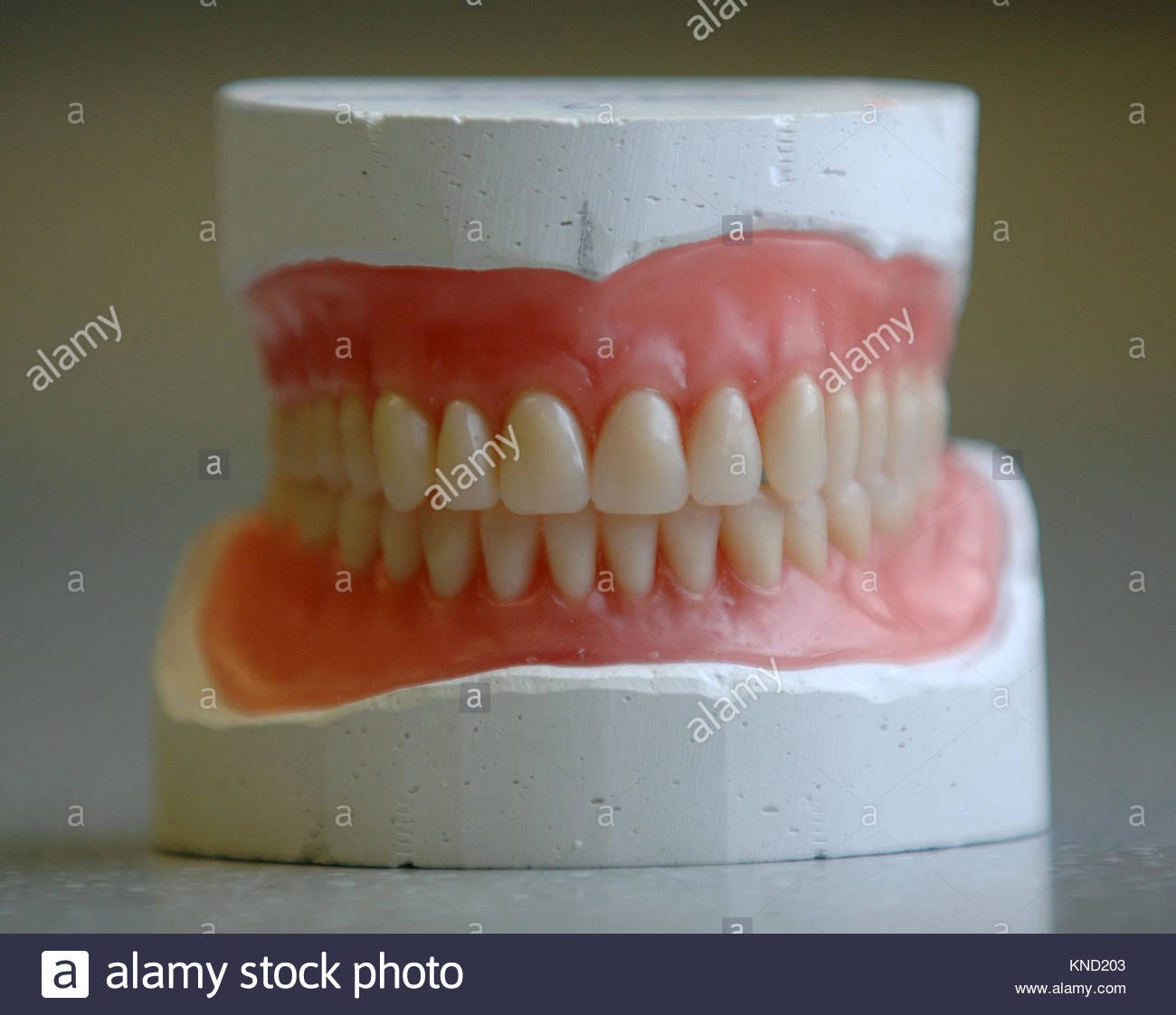 Why Is My Tooth Loose — Part 2. CAUSES OF TOOTH MOBILITY | by Dr ...