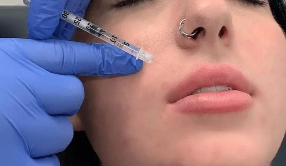 Enhance Your Beauty: Discover the Transformative Power of Dermal ...