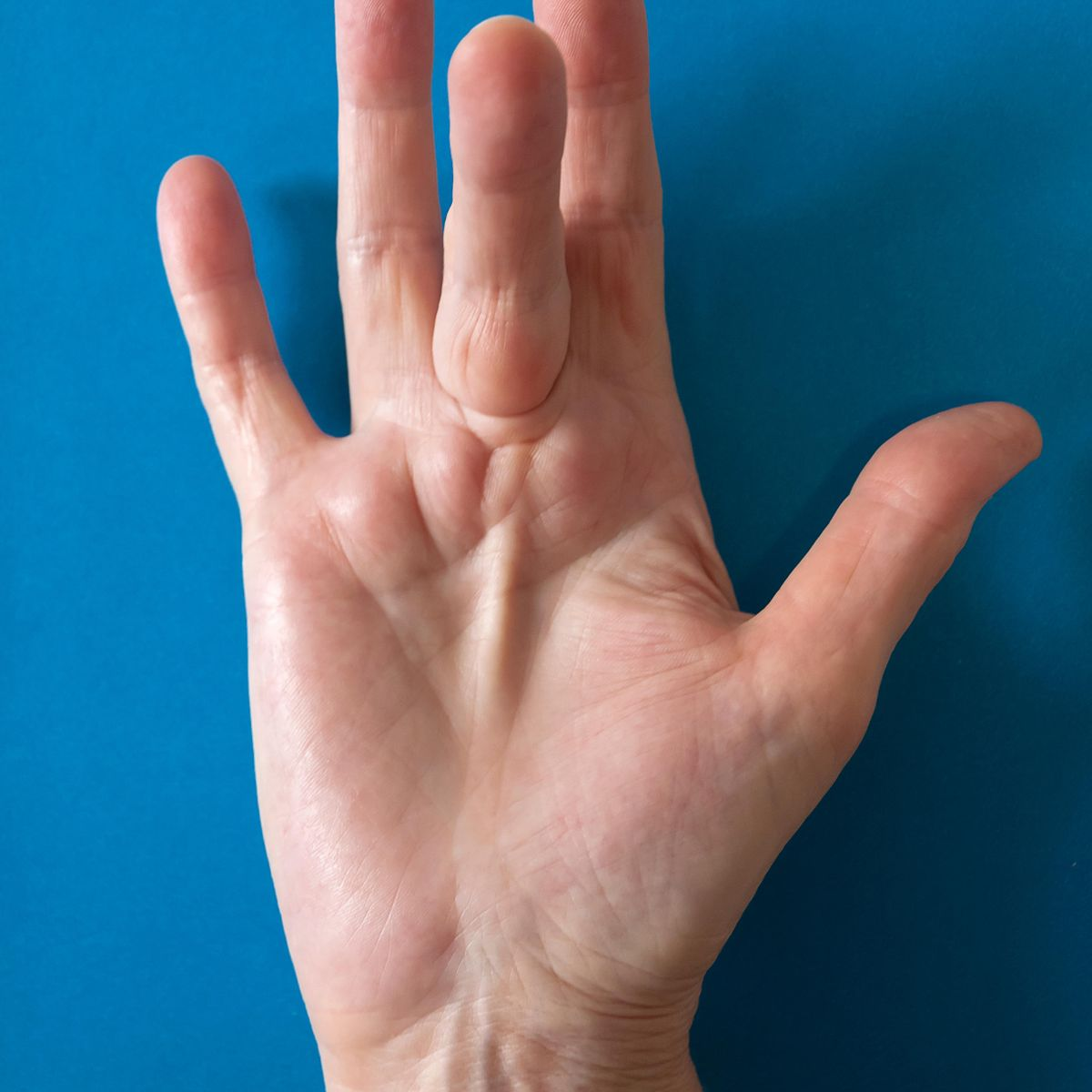 Sensory Integration Intervention (Occupational Therapy) | by Charley Bloggs | Medium