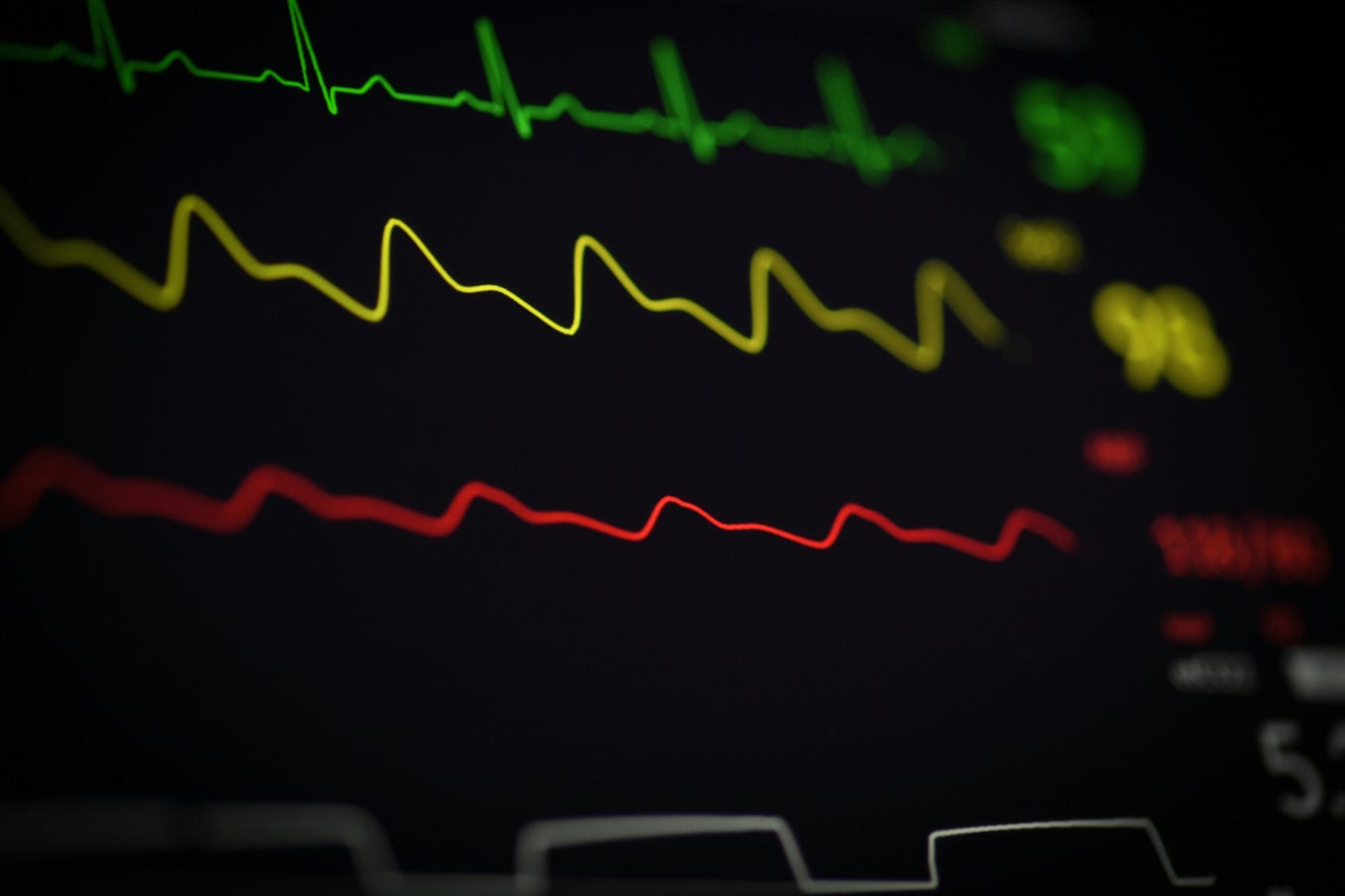 Time Series Forecasting Using Sarima Python Implementation By Can