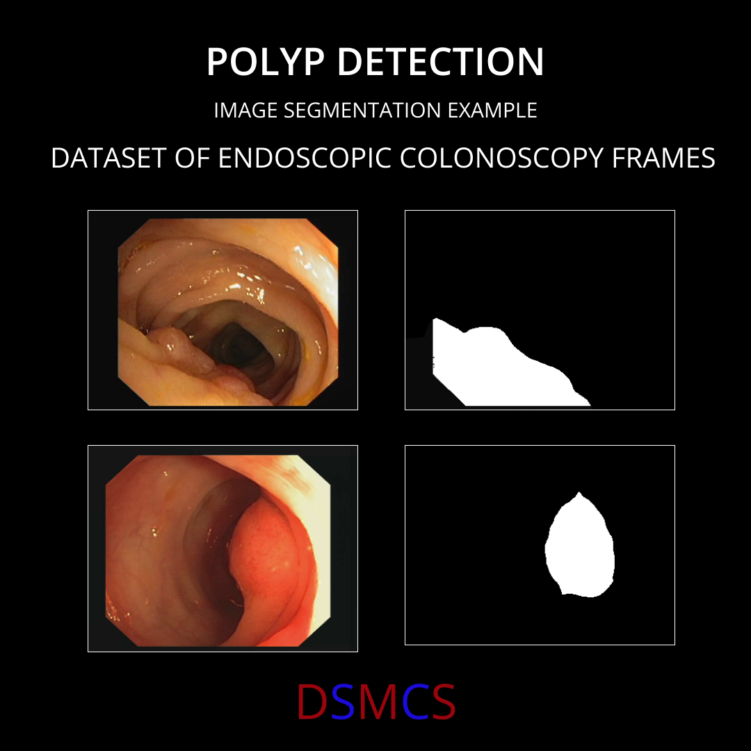 X-Ray Image Segmentation using U-Nets | by TheAIEnthusiast | Becoming Human: Artificial ...