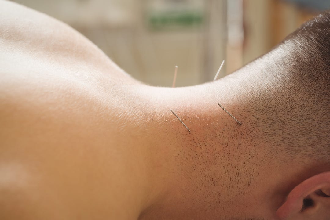 Photobiomodulation, Best Natural Healing Technique | by AcuHealth | Medium