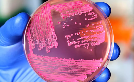 Best Microbiology Testing Lab in India — Chemzin Biotox - Chemzin ...