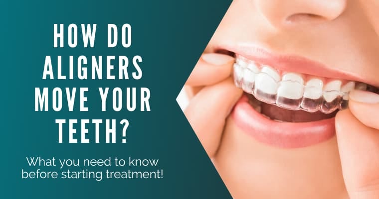 What are the Different Types of Clear Aligners Available? | by ...