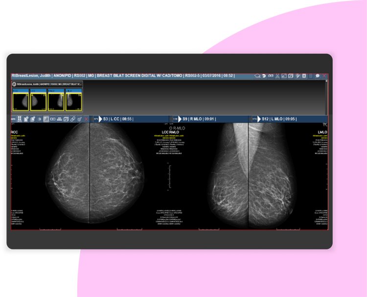Cloud Based Radiology PACS: Revolutionizing Medical Imaging | by ImagingPortal | Sep, 2024 | Medium