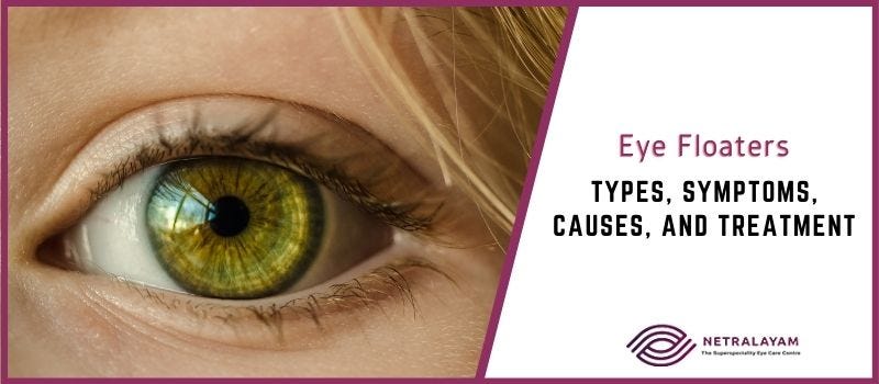 Eye Allergies: Causes, Triggers, Symptoms, Prevention, and Management ...