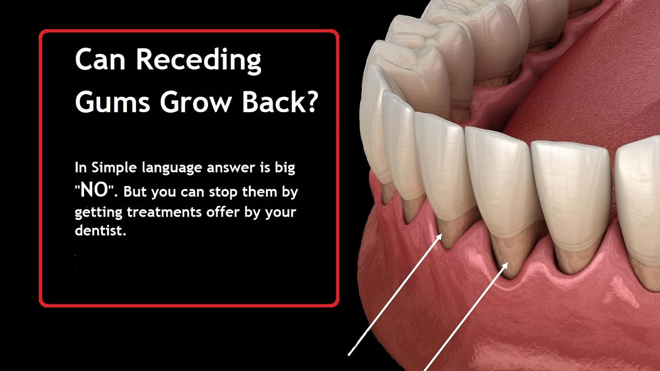 What Are the Methods for Encouraging Receding Gums to Grow Back ...