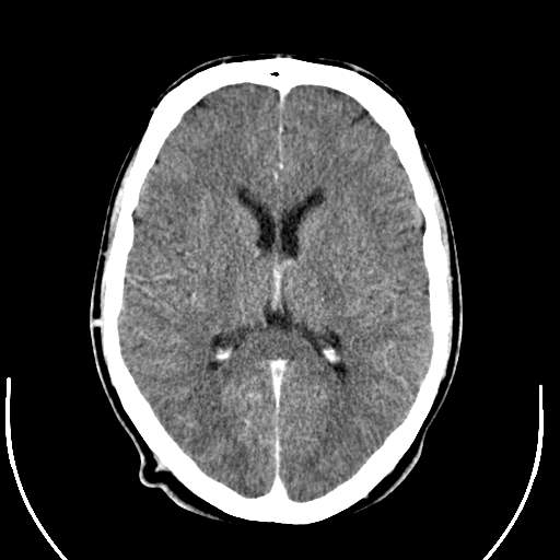 Picasso: A free open-source visualizer for Convolutional Neural Networks | by Ryan Henderson ...