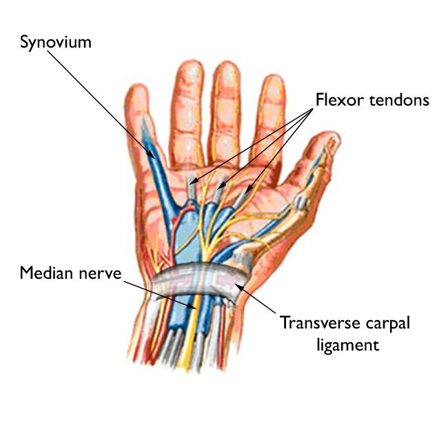 “Enhancing Mobility: Exploring Radial Tunnel Syndrome Treatment Options ...