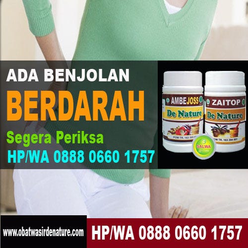 Obat Tradisional Wasir Stadium 4. OBAT TRADISIONAL WASIR STADIUM 4 ...