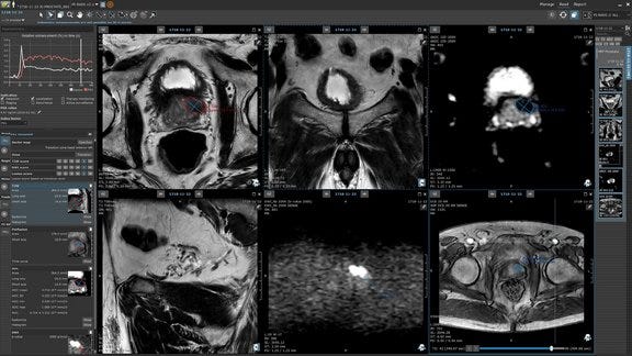 Different Types of Medical Imaging: A Comprehensive Guide | by Mongkut ...