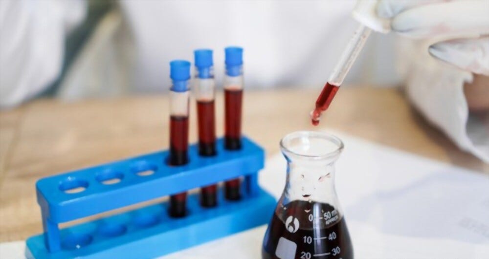 5 Essential Blood Tests Everyone Should Get Regularly | by ...